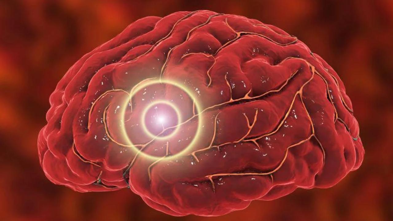 Uncovering Hidden Consciousness in Comatose Brains | Columbia Neurology Uncovering Hidden Consciousness in Comatose Brains | Columbia Neurology