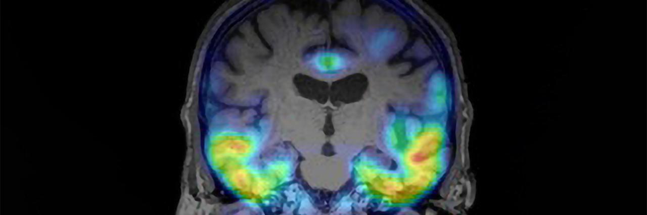 ADAPT Lab | Columbia Neurology