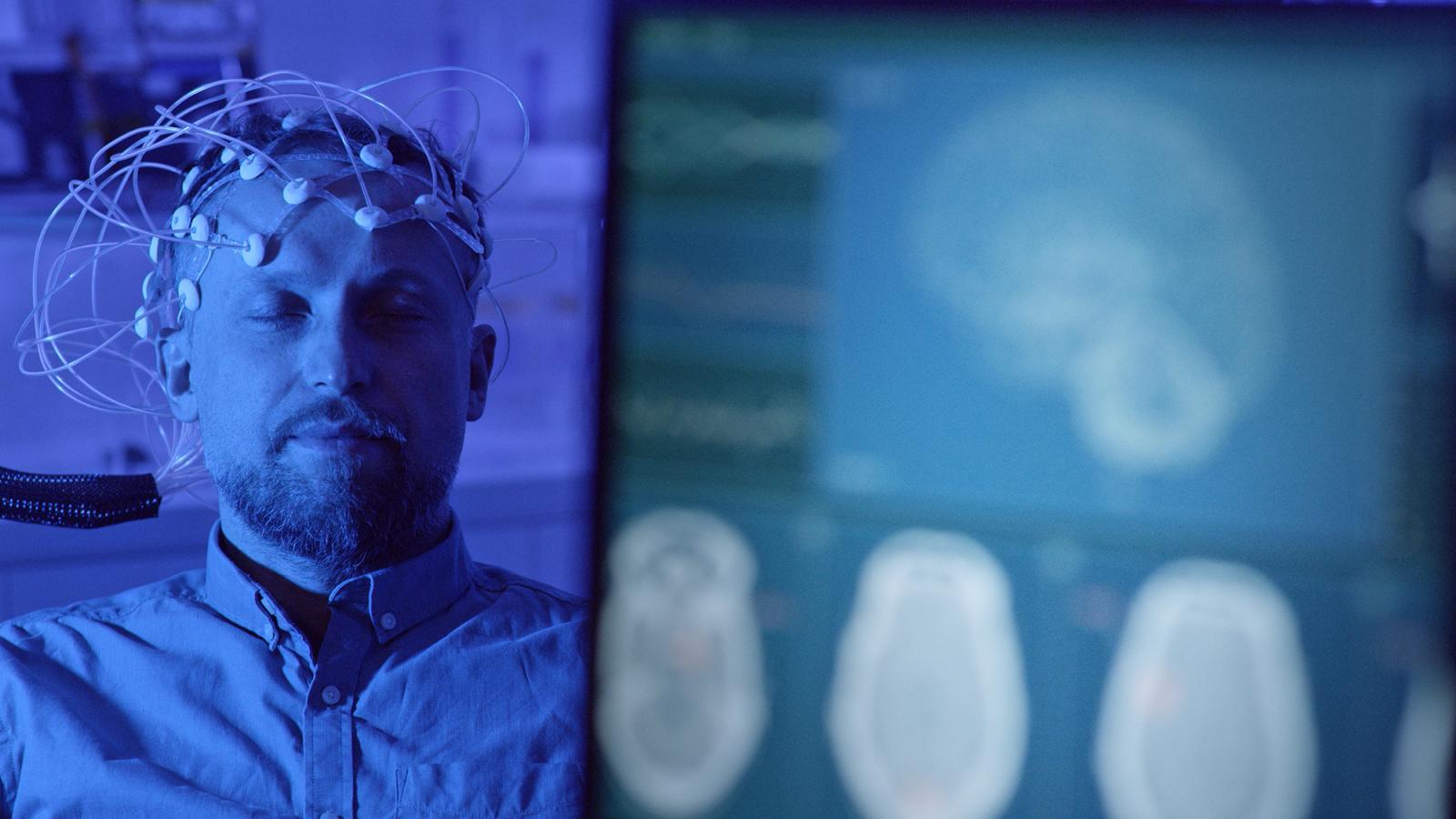 Epilepsy & Sleep Research | Columbia Neurology