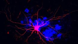 News | Columbia Neurology